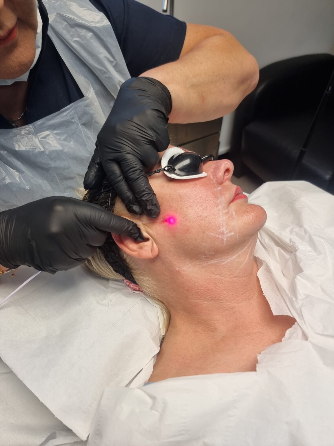 Endolifting Laser Devices with CE